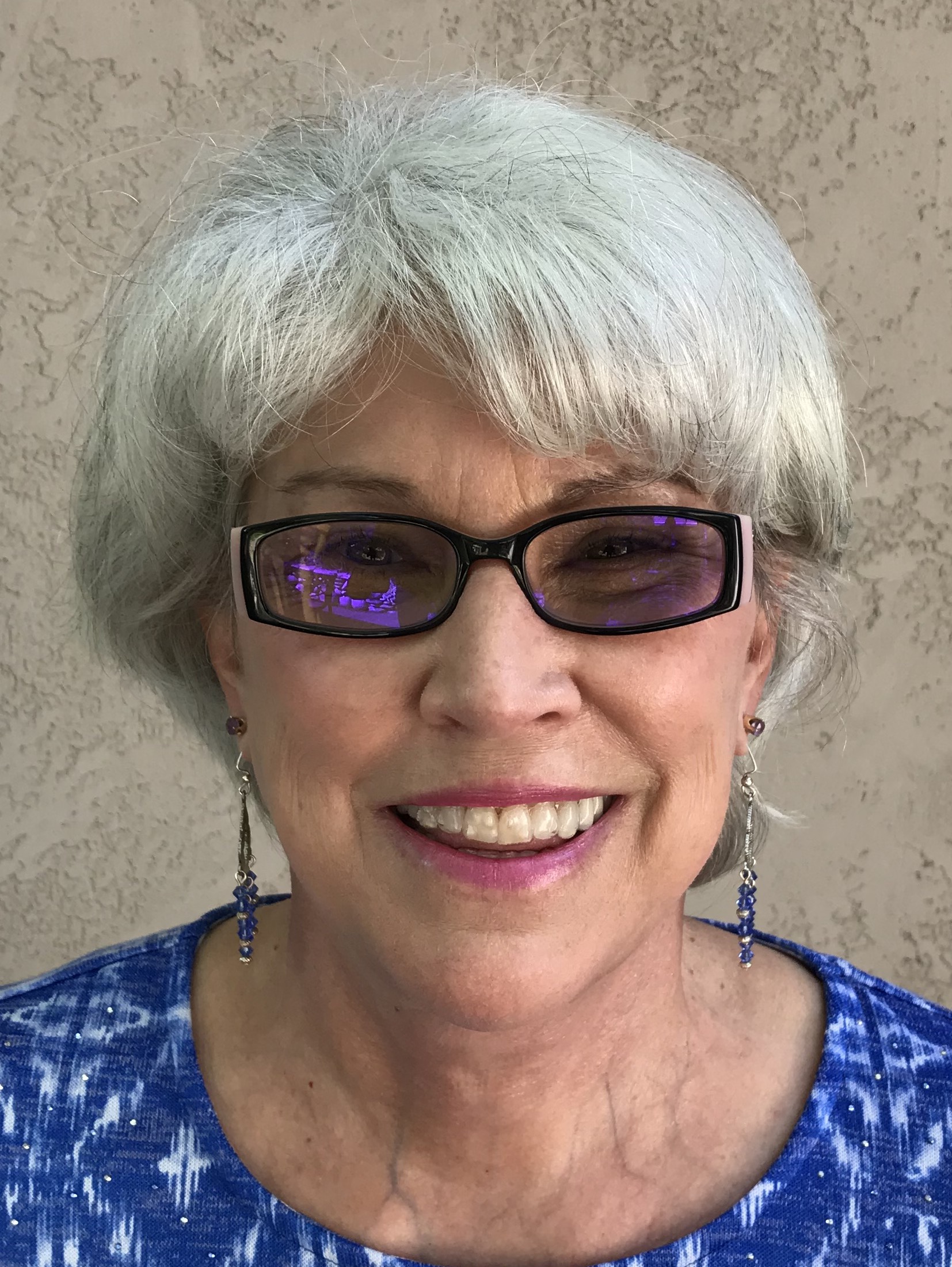 Facelift Reveal – Erin Burrell