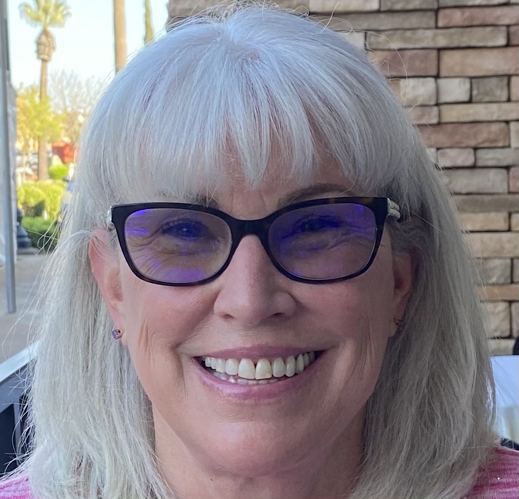 MY FACELIFT – 2 YEARS LATER – Erin Burrell